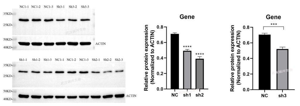 Western Blot 检测 – 空间转录组 | 单细胞多组学 | 三代测序 | RNA调控研究技术服务 – 瑞兴生物